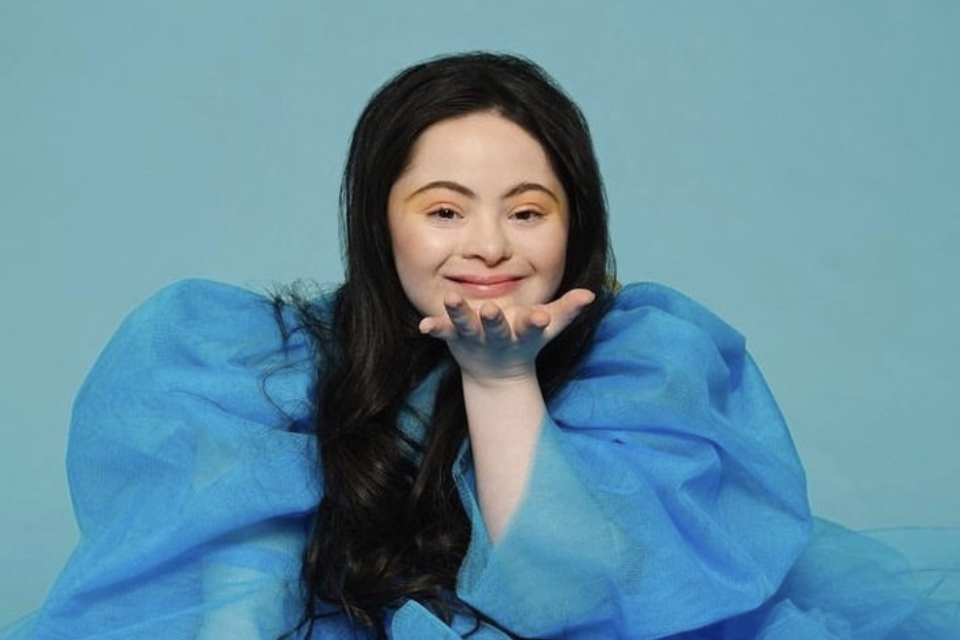 Ellie Goldstein, Model Down Syndrome Pertama di Industri Fashion ...
