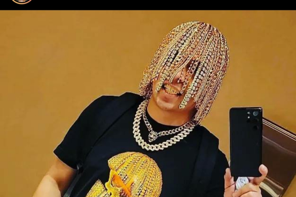 Rapper Dan Sur Implan Rambut dari Rantai Emas di Tengkorak Kepala ...