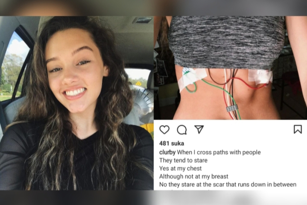 7 Fakta Claire Bridges, Model yang Kakinya Diamputasi karena Covid-19 ...