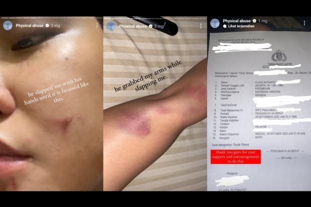 Pengakuan Clara Tan Dipukuli Mantan Pacar hingga Bagikan Bukti Foto - Hits Katadata.co.id
