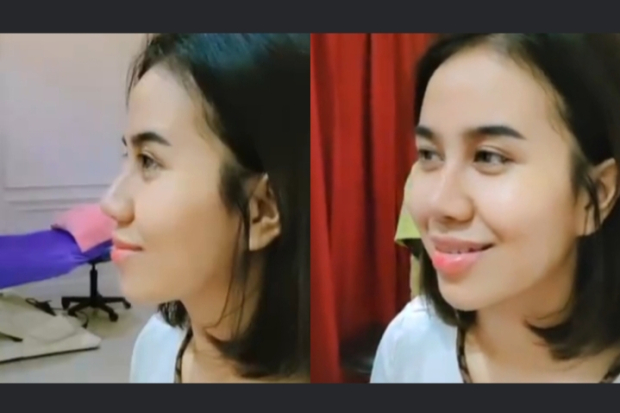 Mayang Pamer Hidung Baru Usai Jalani Operasi Plastik - Hits Katadata.co.id